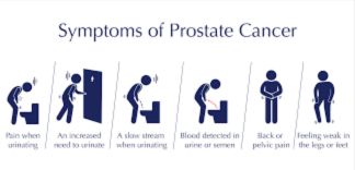 Prostate cancer - Diagnosis and treatment by Ashish Goel